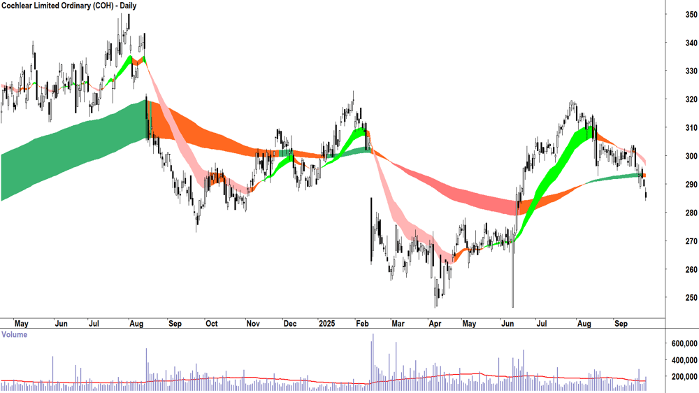 ChartWatch ASX Scans: Mineral Resources, Lynas Rare Earths, Global X ...